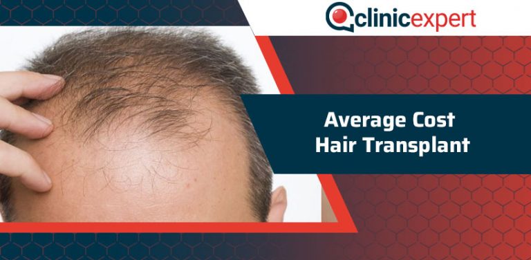 Average Hair Transplant Cost In Turkey Hair Transplant Clinicexpert
