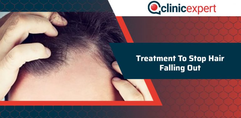 Treatment To Stop Hair Falling Out Clinicexpert
